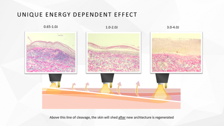 NeoGen Plasma – Inspira Dermatology – Dermatology Clinic